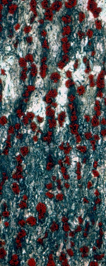 Beech Bark Disease | Forest Pathology